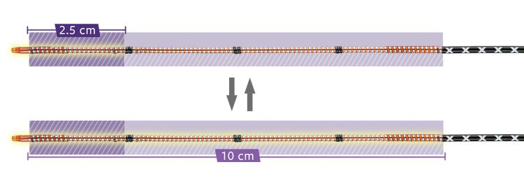 A NEW RF SYSTEM: VENCLOSE 2ND GENERATION RADIOFREQUENCY TECHNOLOGY ...