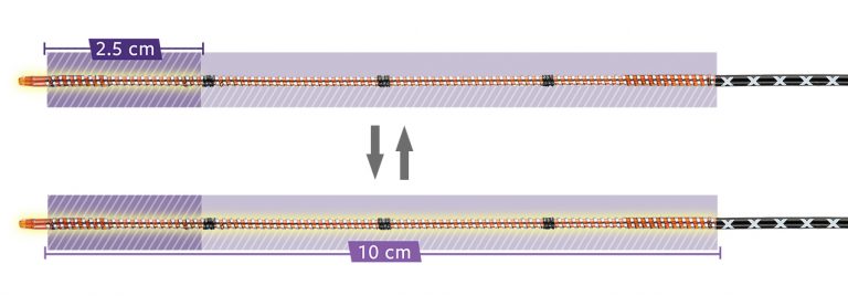 A NEW RF SYSTEM: VENCLOSE 2ND GENERATION RADIOFREQUENCY TECHNOLOGY ...